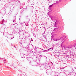 oesophagus microscope
