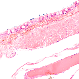 earthworm microscope