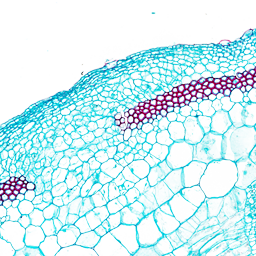 Collenchyma Under Microscope