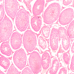 Labeled Epididymis Microscope Slide